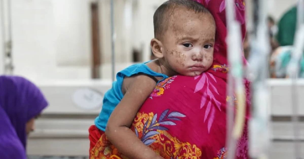 Measles death toll 585, two more deaths in 24hrs